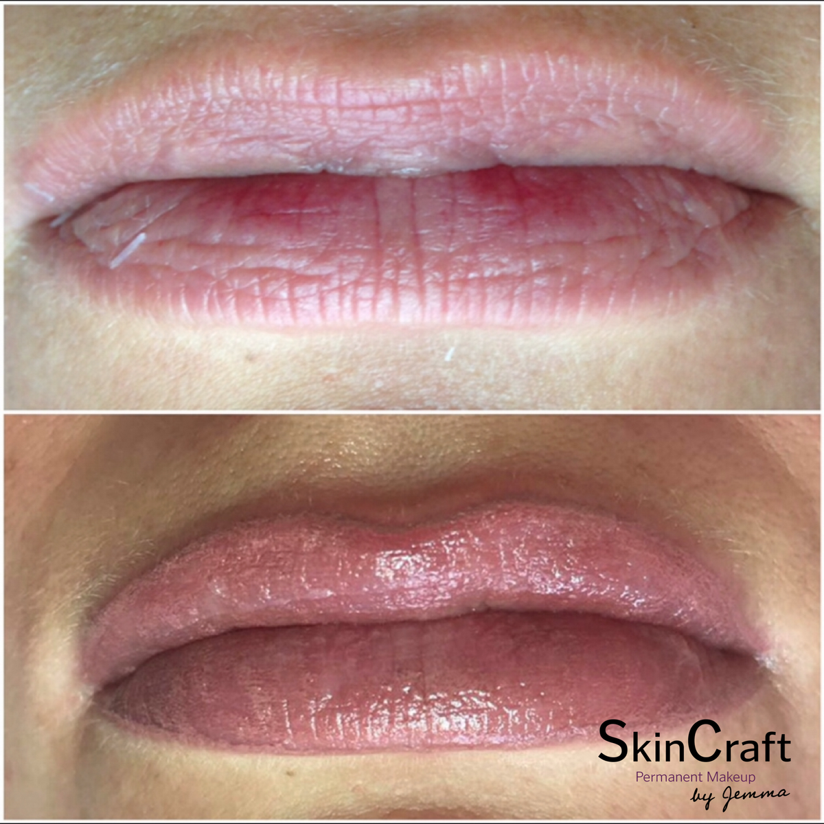 Permanent Lips | Treatment | SkinCraft – SkinCraft